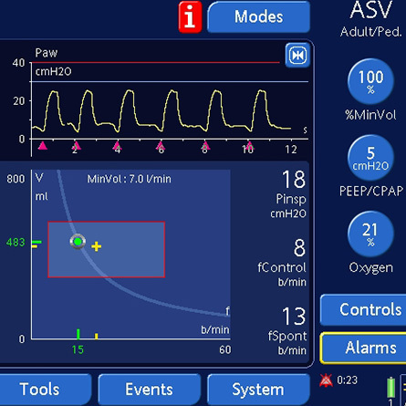 ASV - Adaptive Support Ventilation, Intelligent Ventilation Solutions ...